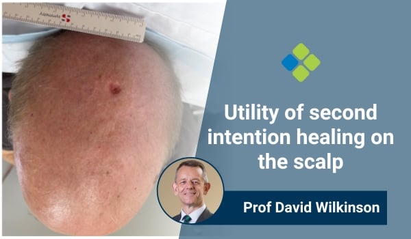 Utility of second intention healing on the scalp